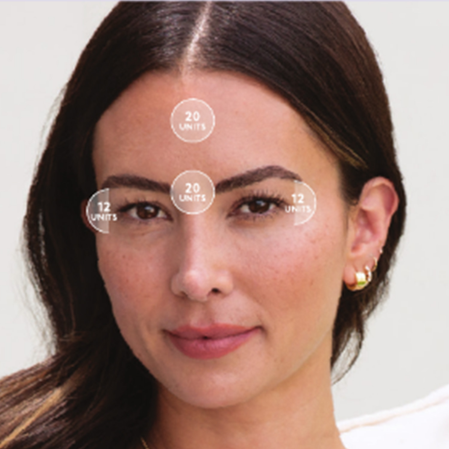 Arlington Botox Treatment Cost, Before & After Photos